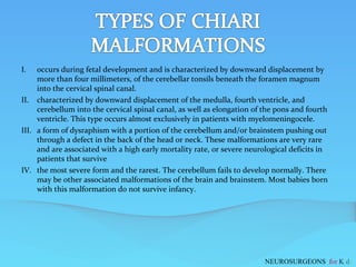 Chiari Malformations By Eric Trumble, MD | PPT