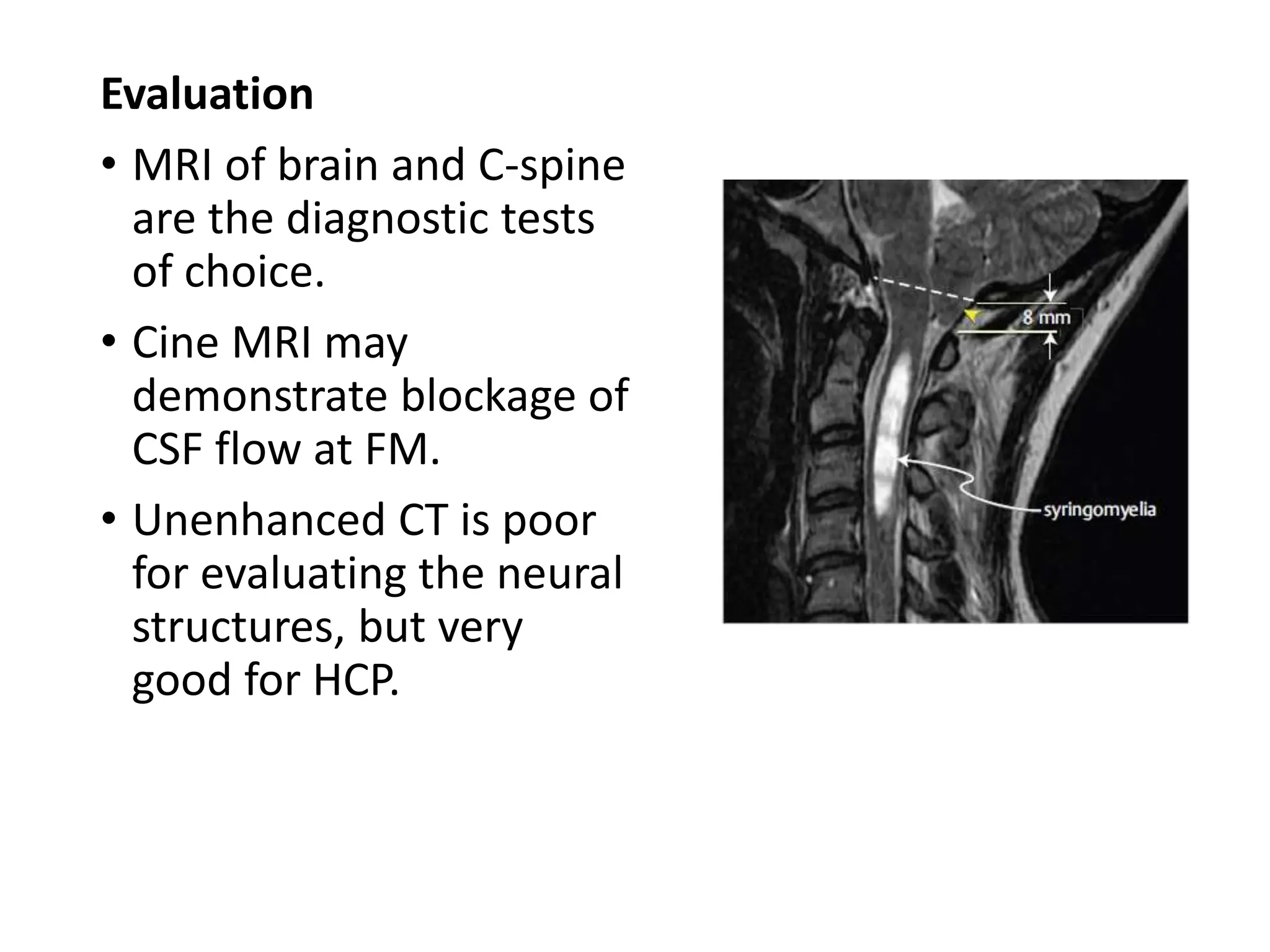 Chiari Malformations.pptx