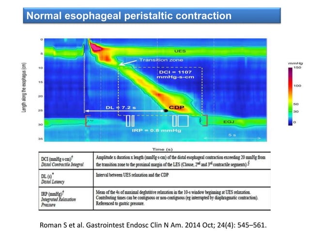 Chicago classification version 4.0: HRM classification of esophageal ...