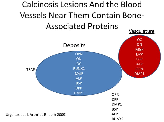 Scleroderma & the hands - Calcinosis | PPT