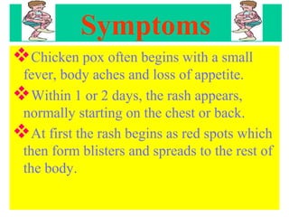 Chicken poox | PPT