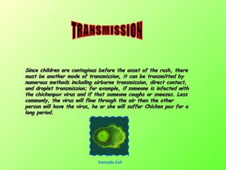 Chicken Pox | PPT