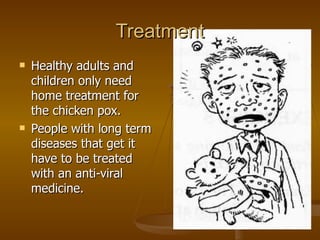 Chicken Pox | PPT