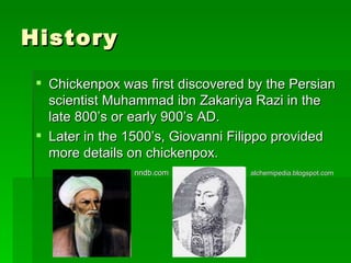 Chickenpox | PPT