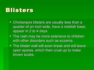 Chickenpox | PPT