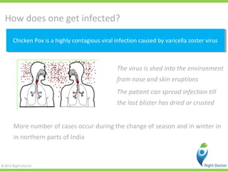 Chickenpox | PPT