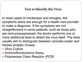 Chicken pox | PPTX