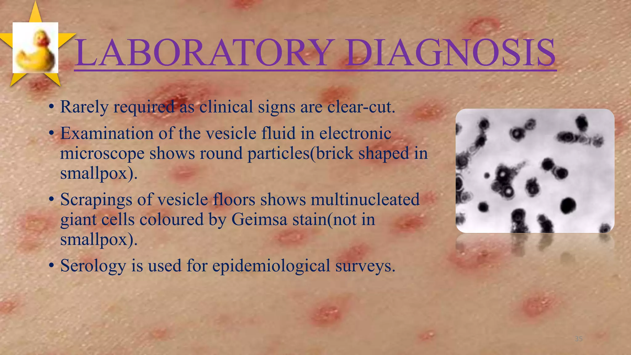 Chickenpox | PPTX