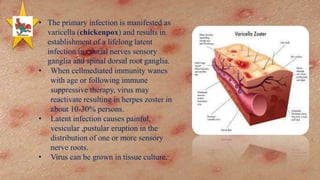 Chickenpox | PPTX