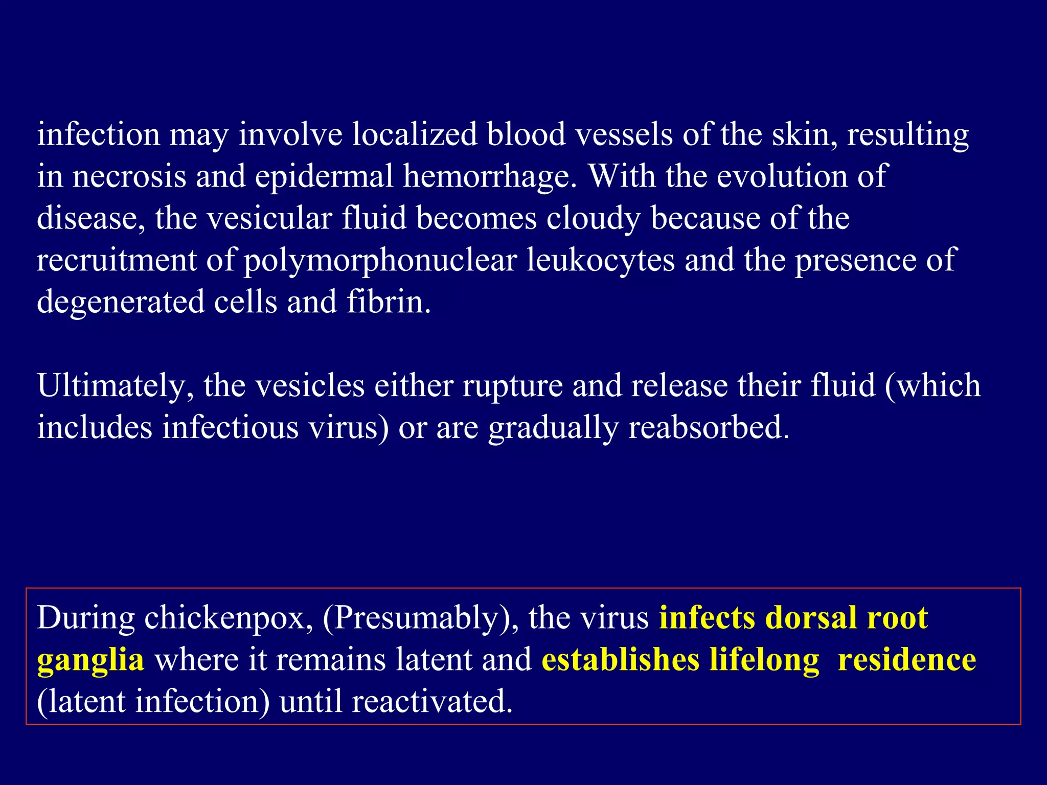 Chickenpox | PPT