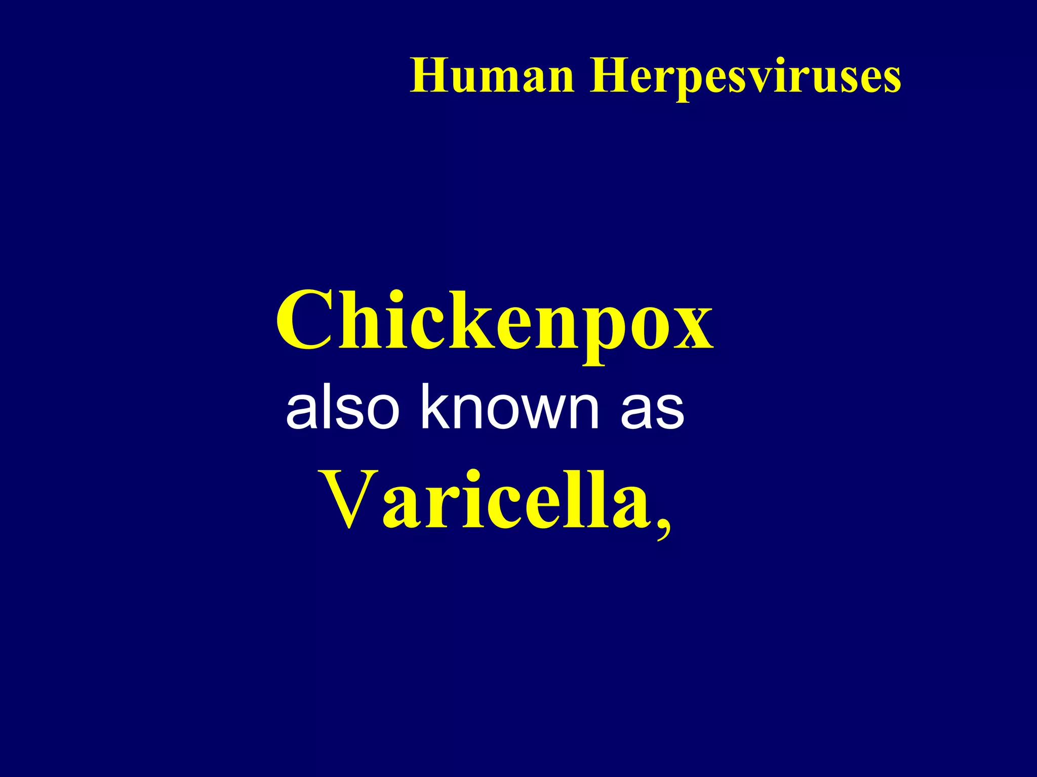Chickenpox | PPT