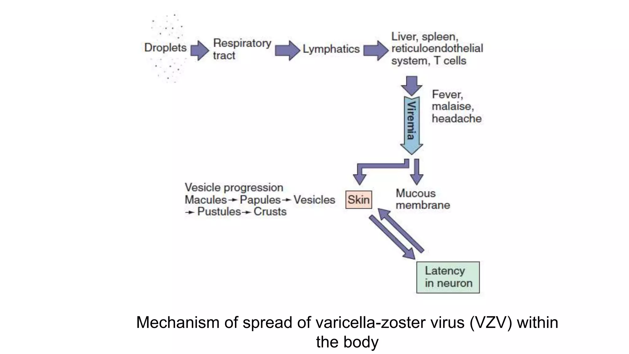 Chickenpox (Varicella) | PPTX