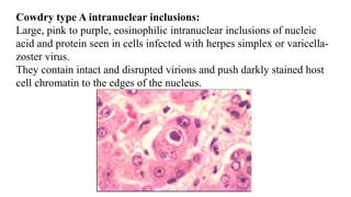 Chickenpox (Varicella) | PPTX