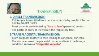 Epidemiology and control measures for CHICKENPOX {Varicella} | PPTX