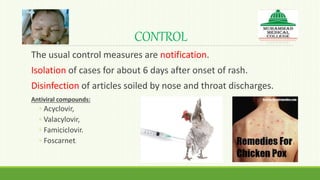 Epidemiology and control measures for CHICKENPOX {Varicella} | PPTX