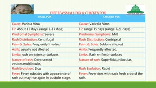 Epidemiology and control measures for CHICKENPOX {Varicella} | PPTX