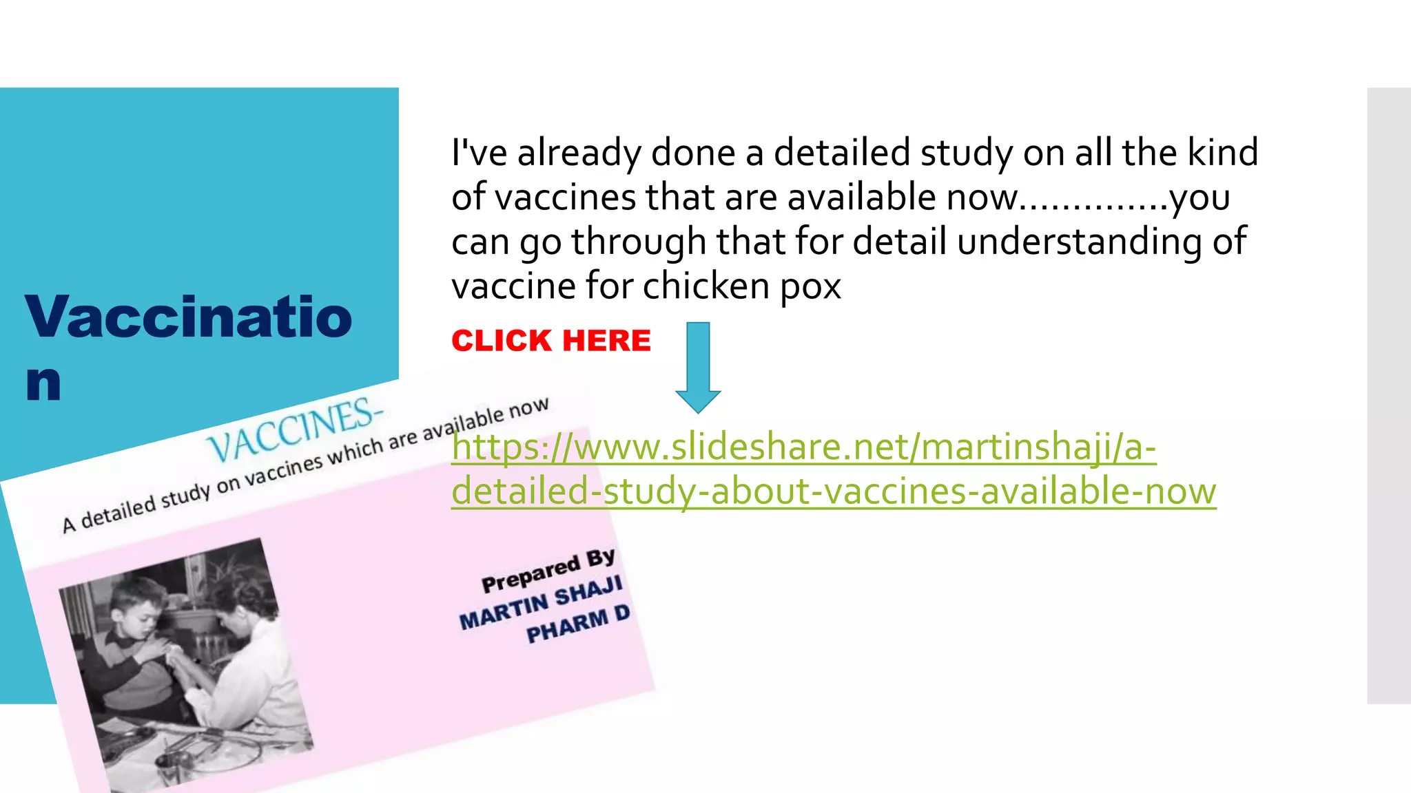 Chickenpox -symptoms |tests |management ( medical information ) | PPTX