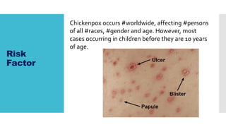 Chickenpox -symptoms |tests |management ( medical information ) | PPTX