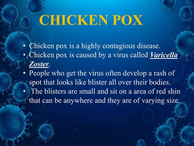 Chicken pox | PPT