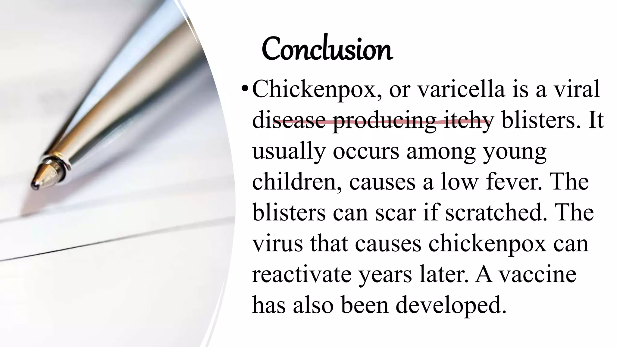 Chicken Pox.pptx