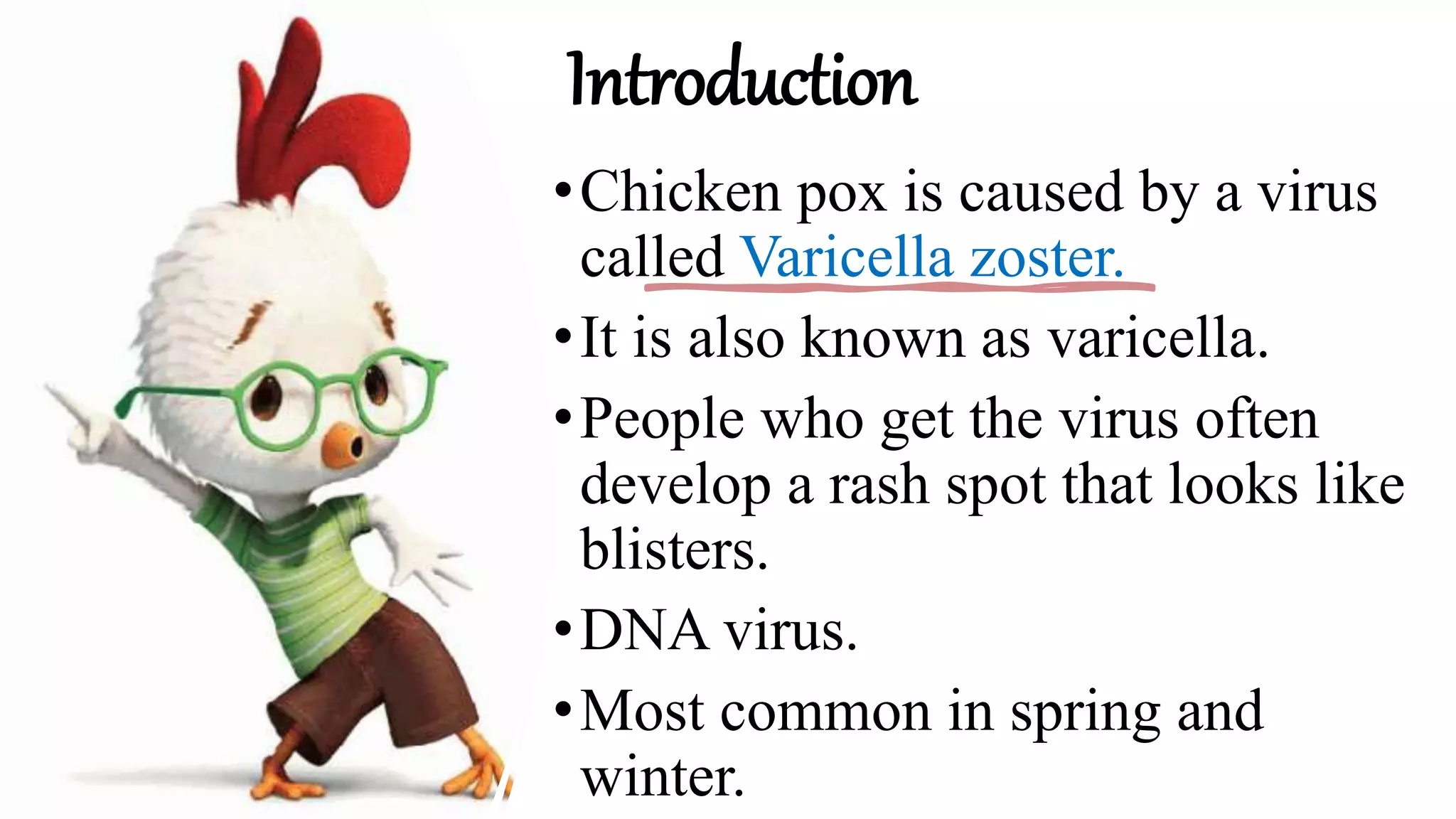 Chicken Pox.pptx