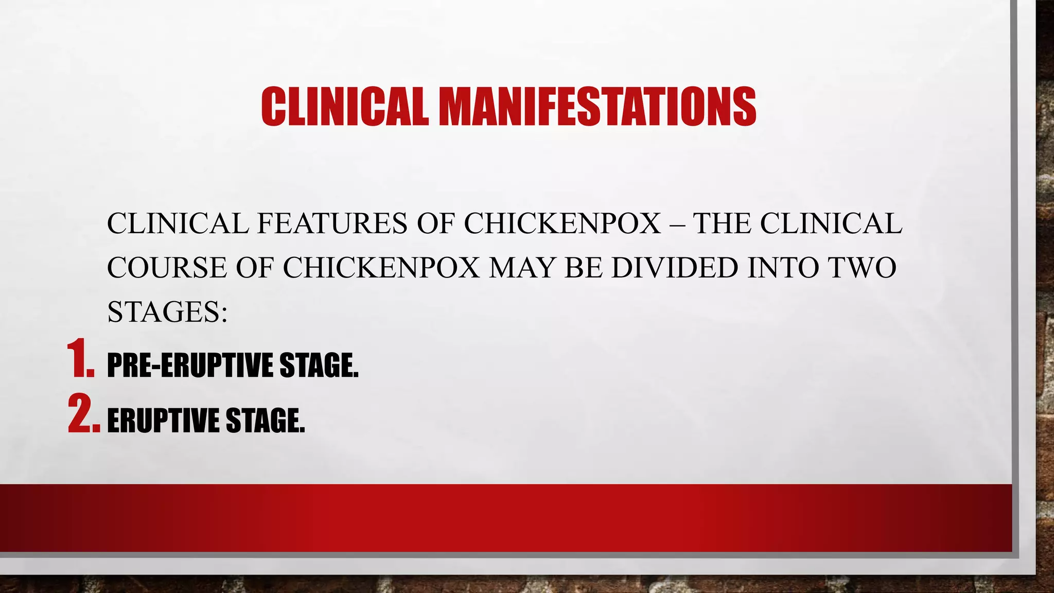 chickenpox | PPTX