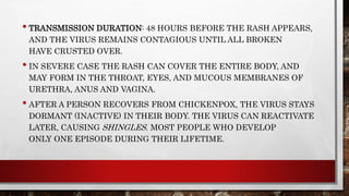 chickenpox | PPT