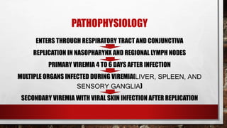 chickenpox | PPTX