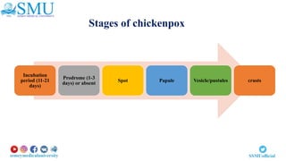 Chickenpox in children ppt for medical students | PPT