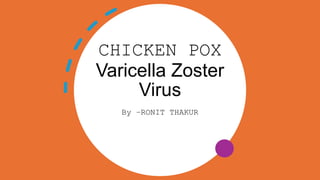 CHICKEN POX varicella Zoster Virus.pptx