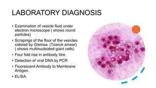 CHICKEN POX varicella Zoster Virus.pptx