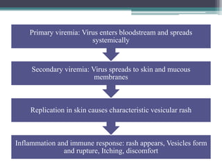 CHICKENPOX.pptx | Infectious Diseases | Diseases and Conditions