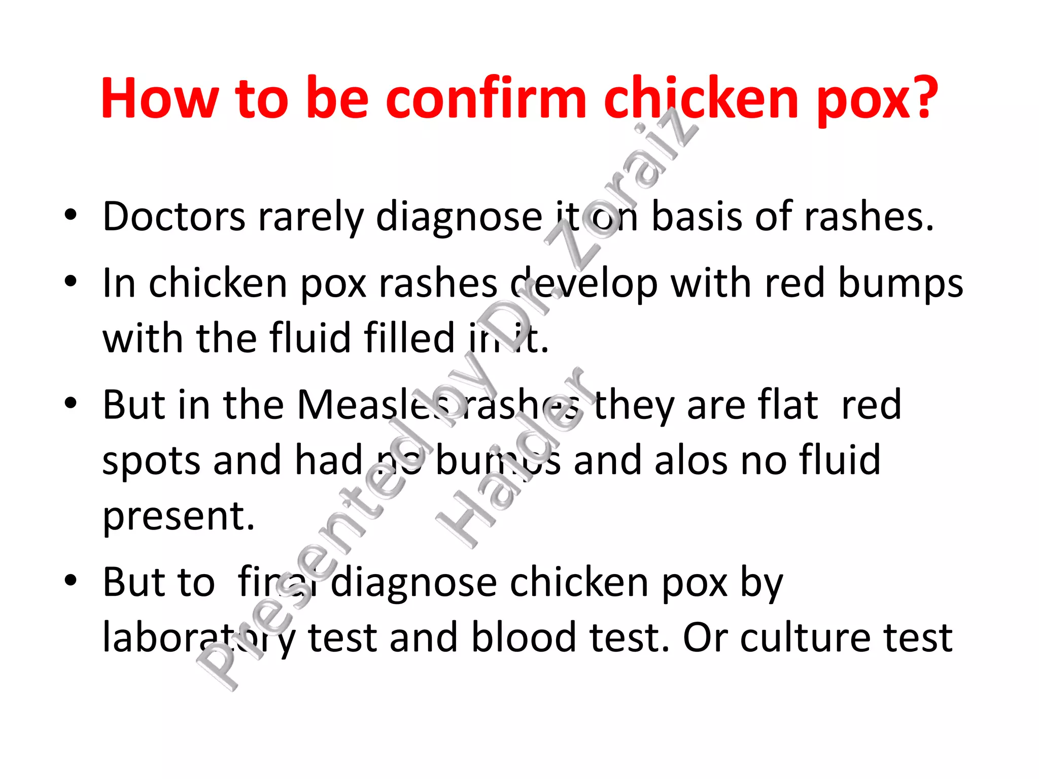 Chicken pox | PDF