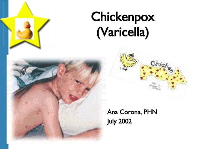 Chickenpox Presentation | PPT