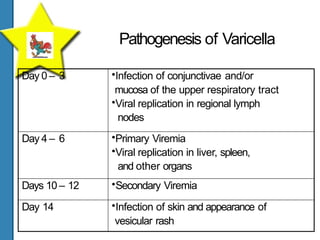 chickenpox-presentation in children medical | PPTX