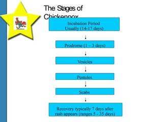 chickenpox-presentation in children medical | PPTX