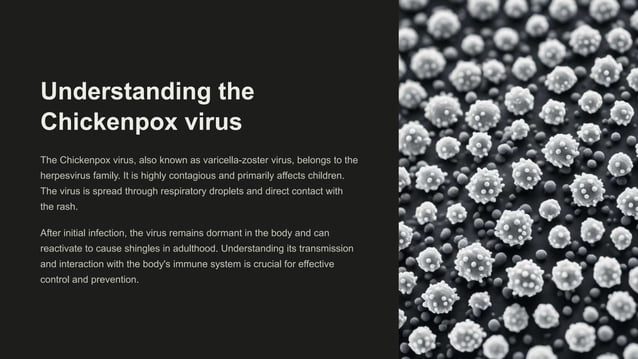 Epidemiology Prevention and control of chickenpox | PPTX | Infectious ...