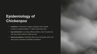 Epidemiology Prevention and control of chickenpox | PPTX