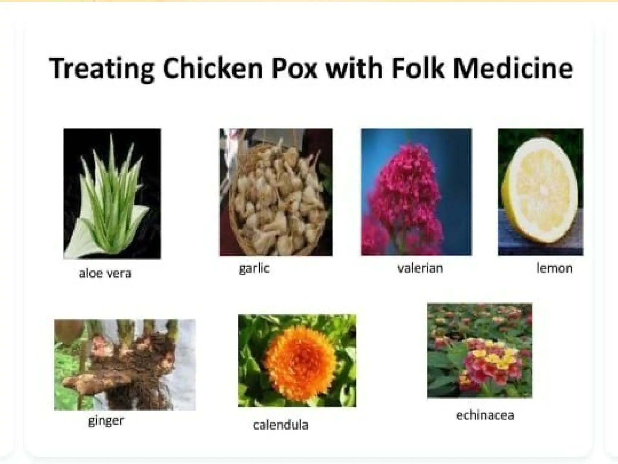 CHICKEN POX , definition, pathophysiology prevention and treatment. | PPTX