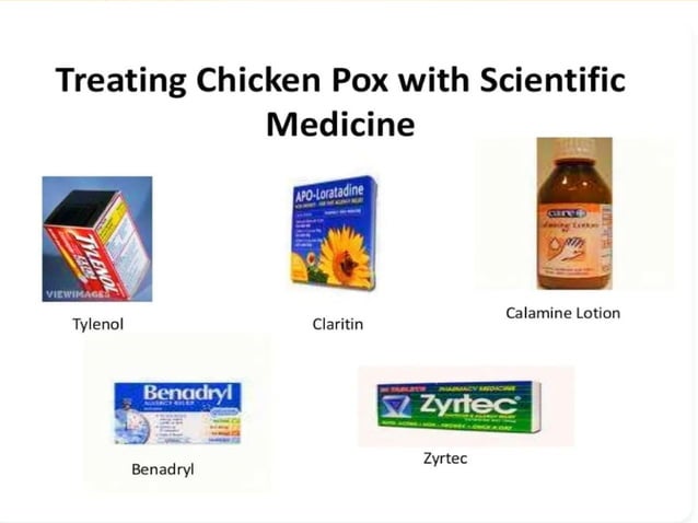 CHICKEN POX , definition, pathophysiology prevention and treatment. | PPTX