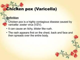 CHICKEN POX , definition, pathophysiology prevention and treatment. | PPTX