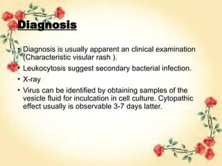 CHICKEN POX , definition, pathophysiology prevention and treatment. | PPTX