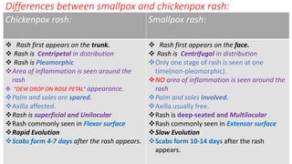Chickenpox and Smallpox.PSM,COMMUNITY MEDICINE,DR NARENDRA KUMAR YADAV ...