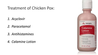 Chickenpox and Smallpox.PSM,COMMUNITY MEDICINE,DR NARENDRA KUMAR YADAV ...