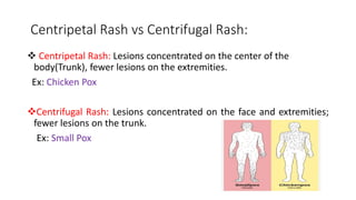 Chickenpox and Smallpox.PSM,COMMUNITY MEDICINE,DR NARENDRA KUMAR YADAV ...
