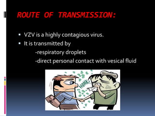 Chickenpox Transmission