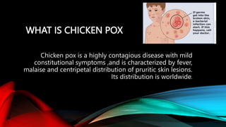 Chicken pox & Rubella.pptx