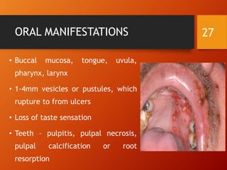 Chicken pox & Shingles | PPTX