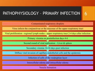 Chicken pox & Shingles | PPTX