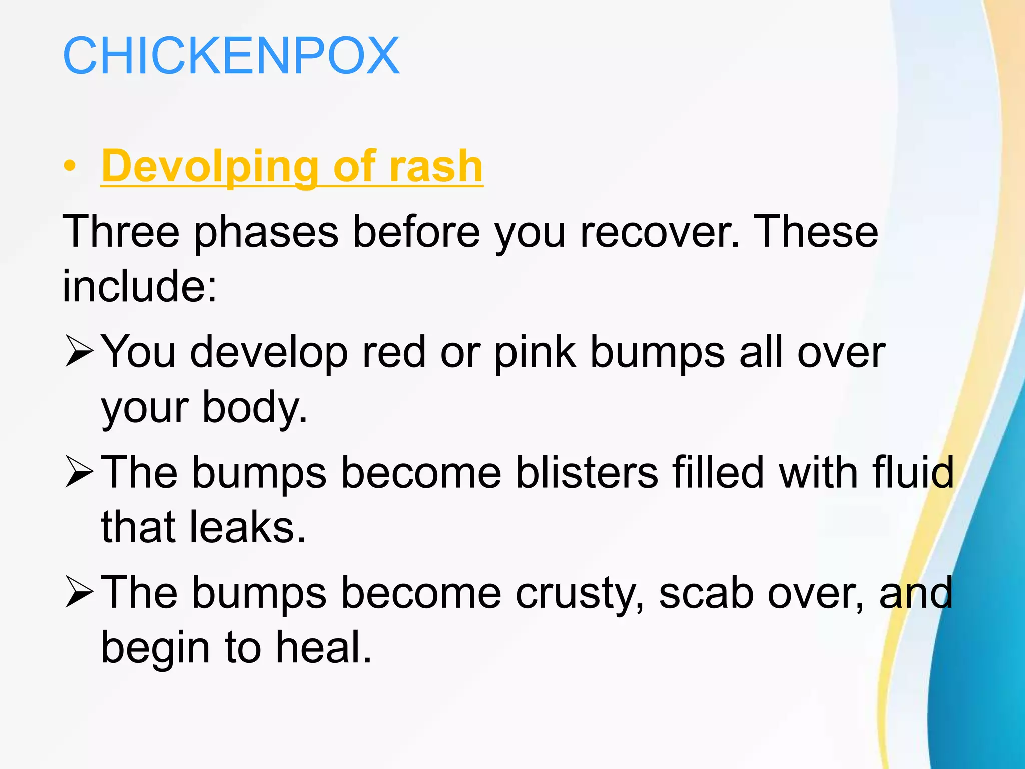 chickenpox & shingles.ppt